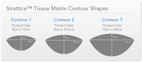 Breast Lift with Augmentation with Strattice | La Jolla Cosmetic ...